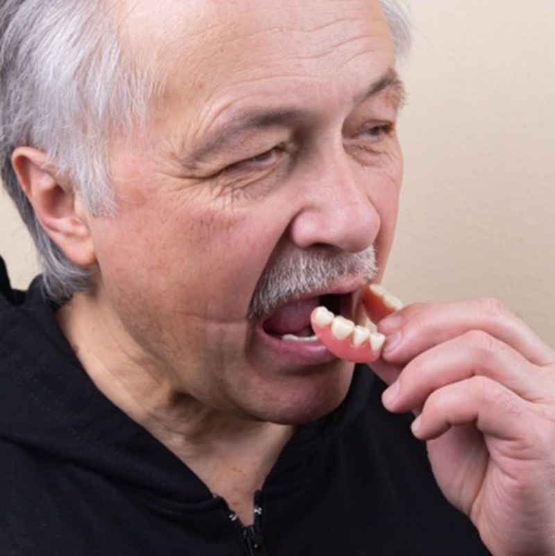 All-on-4, All-on-6_Vietnam Dental Implants & Travel